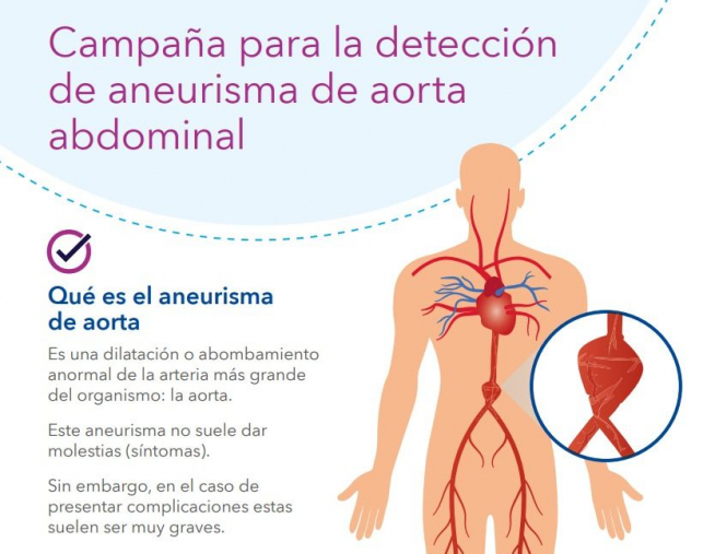 Ecografías gratuitas en Zaragoza para detectar aneurismas de aorta abdominal
