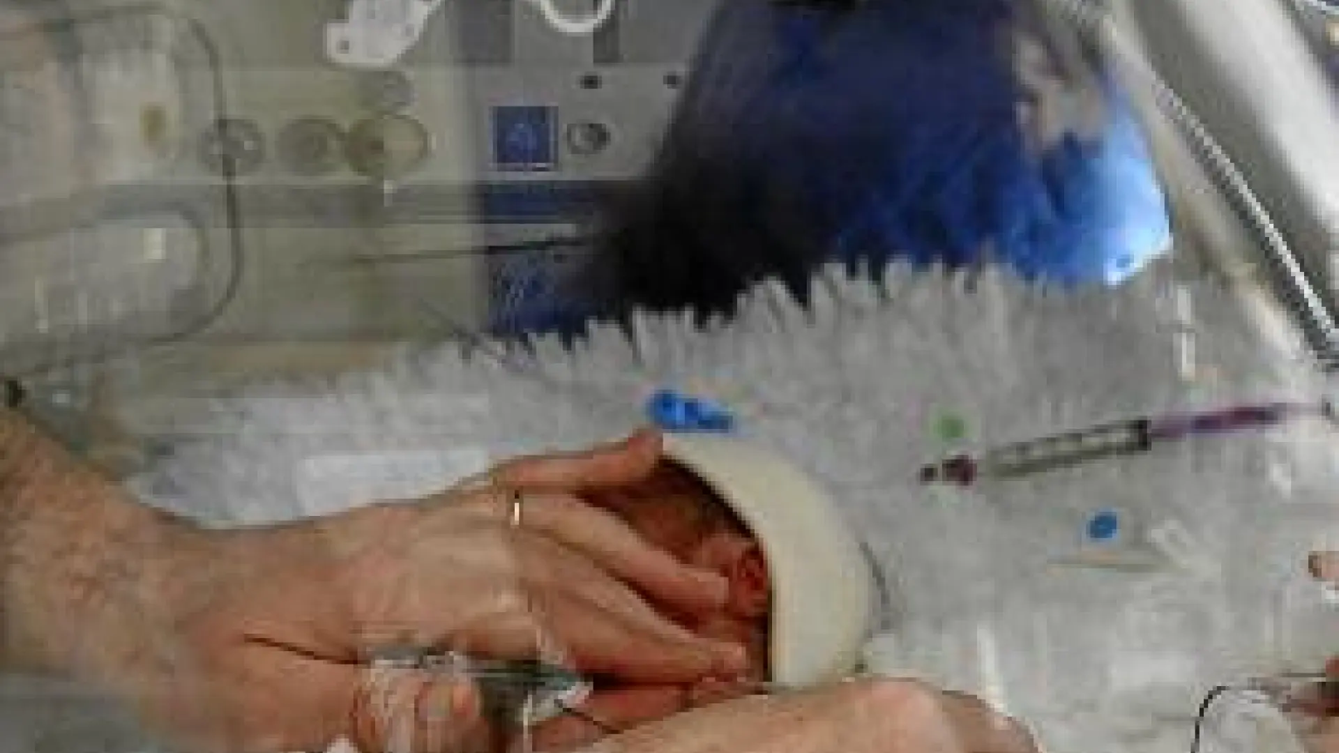 Cada Año Nacen 31 000 Bebés Prematuros En España