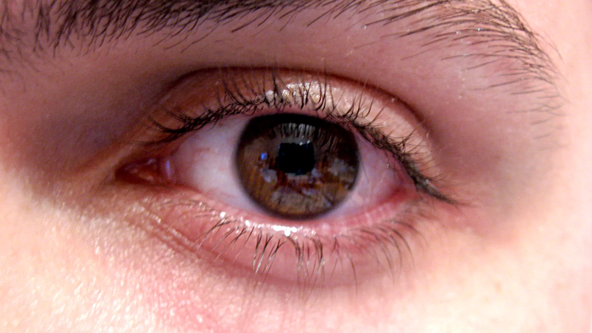 Diseñan un colirio con la propia sangre del paciente para curar daños ...