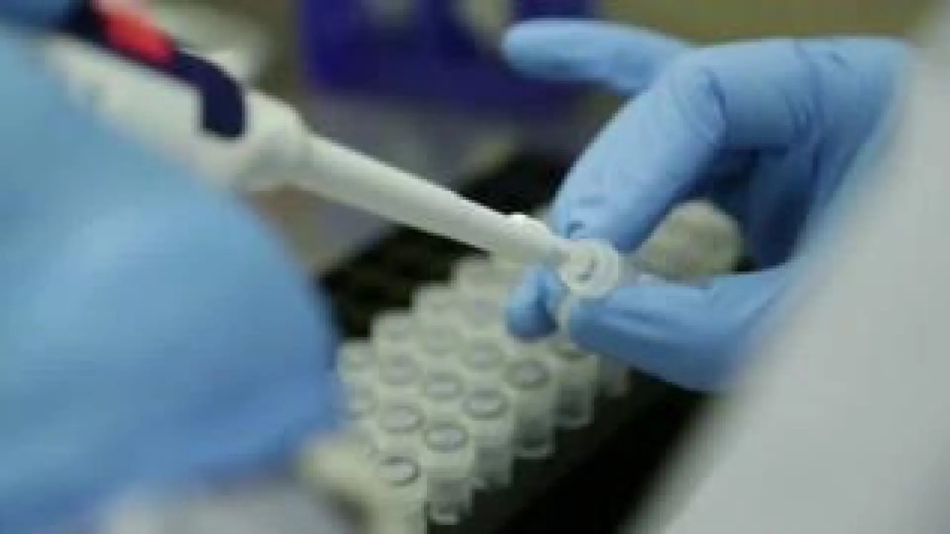 Coronavirus: La inmunidad innata, primera línea de defensa