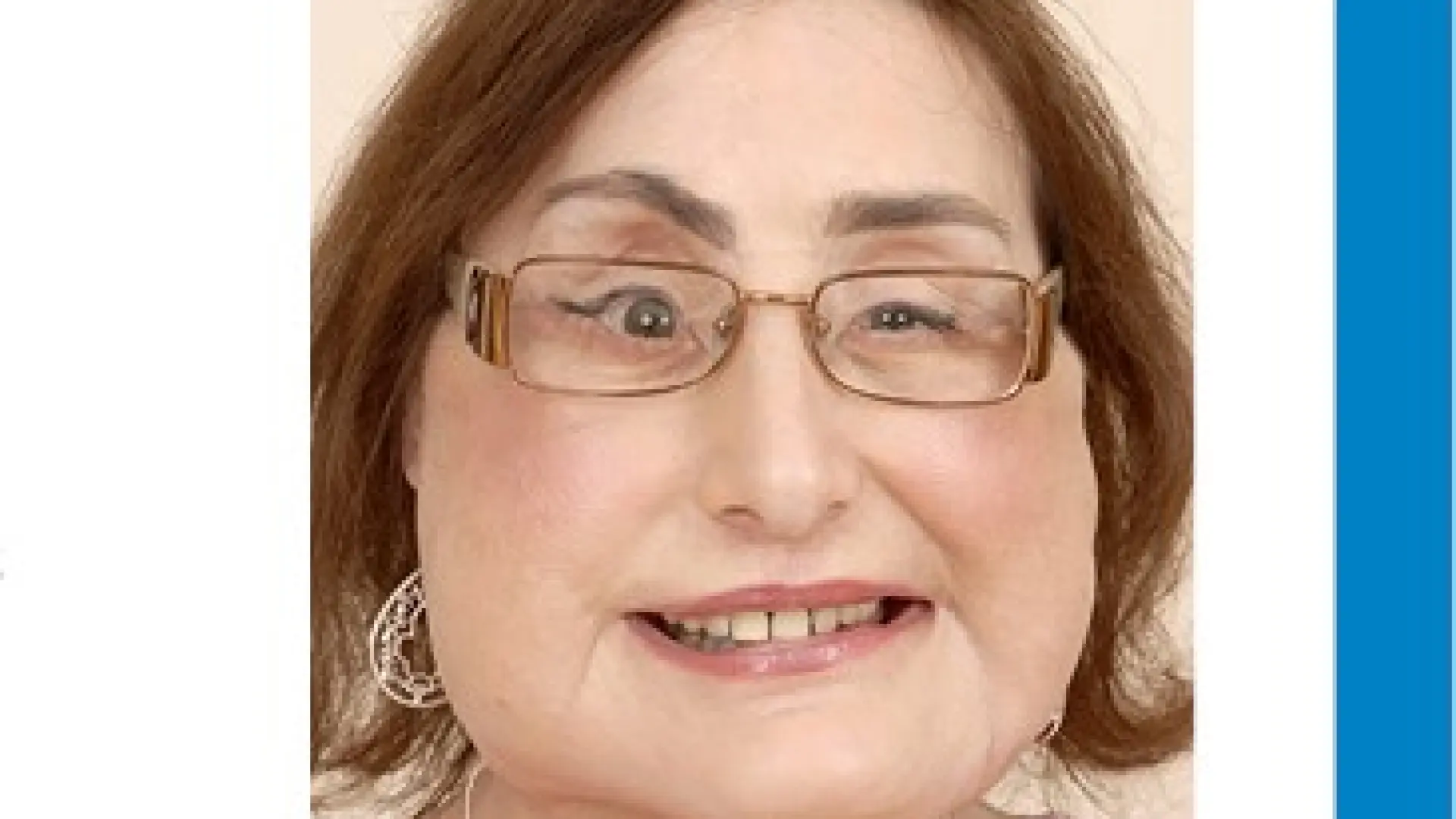 Muere la mujer que recibió el primer trasplante de cara en Estados Unidos