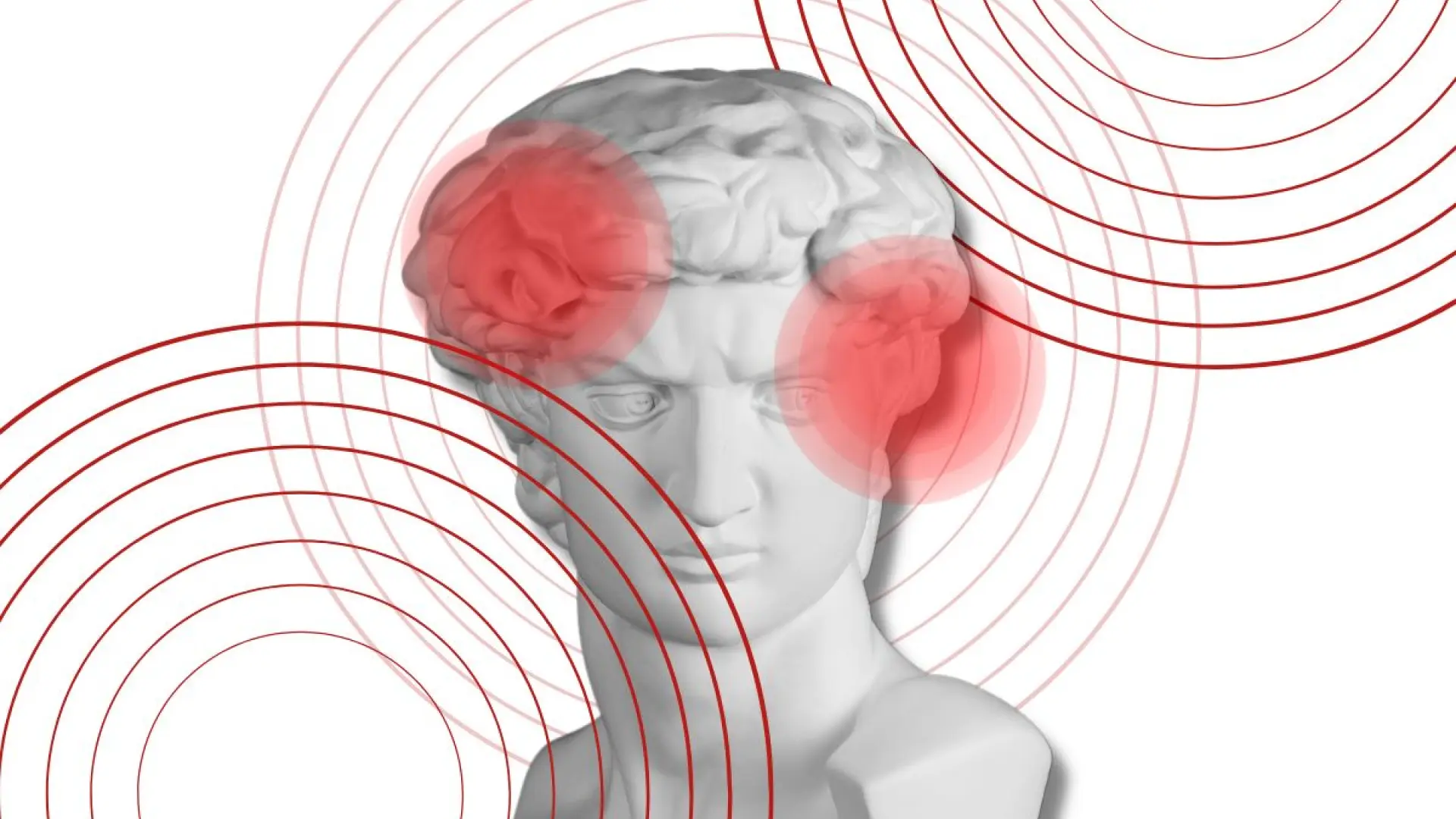 Un estudio revela medicamentos para la migraña más eficaces que el ...