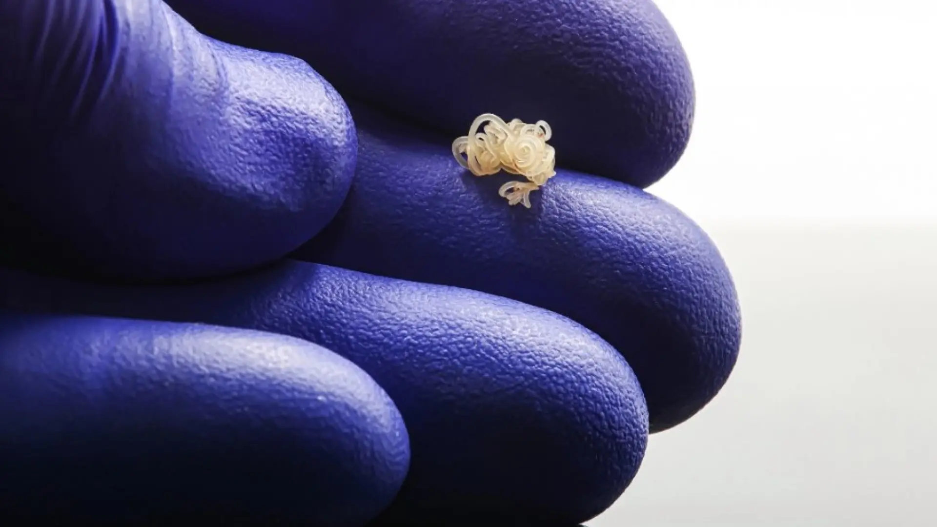 Un ovillo de gusanos parásitos anisakis extraídos de pescado fresco