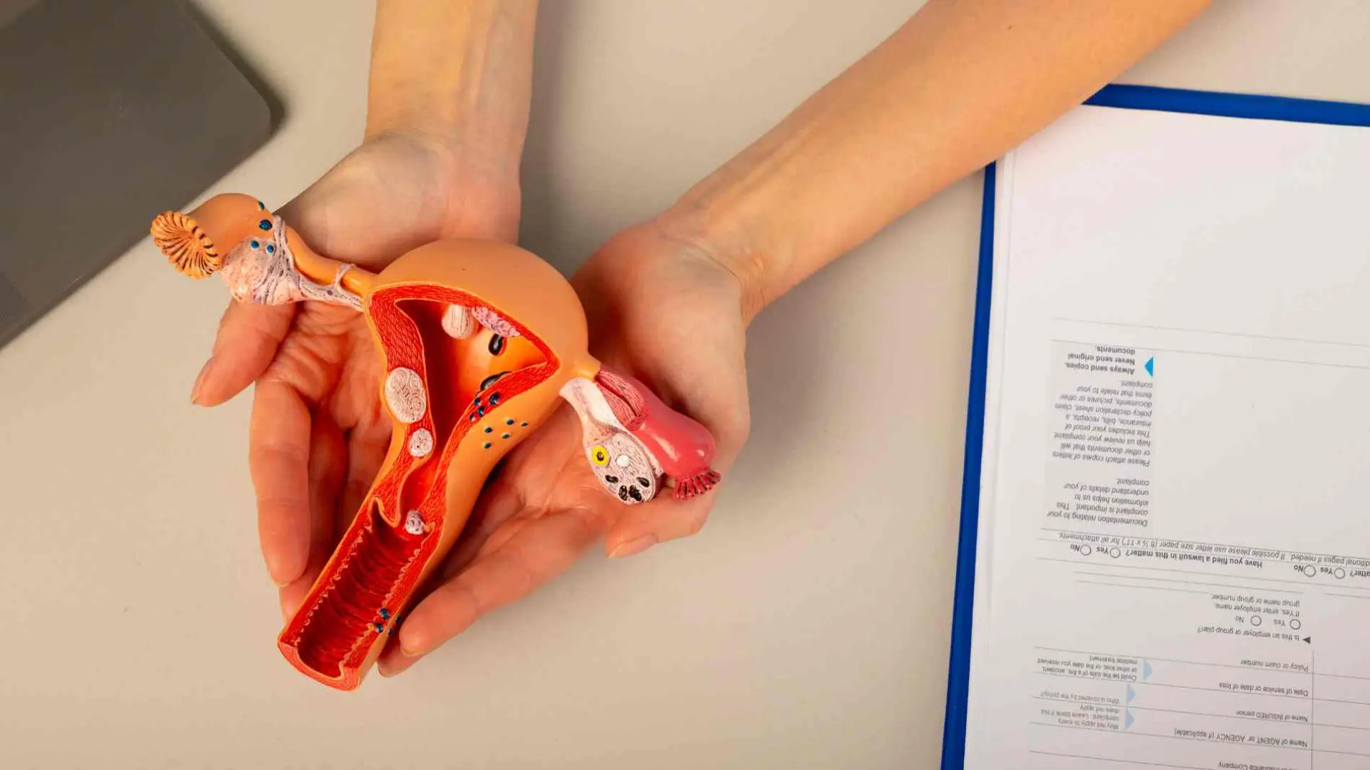 Cómo se manifiesta el cáncer de trompas de Falopio: algunos síntomas