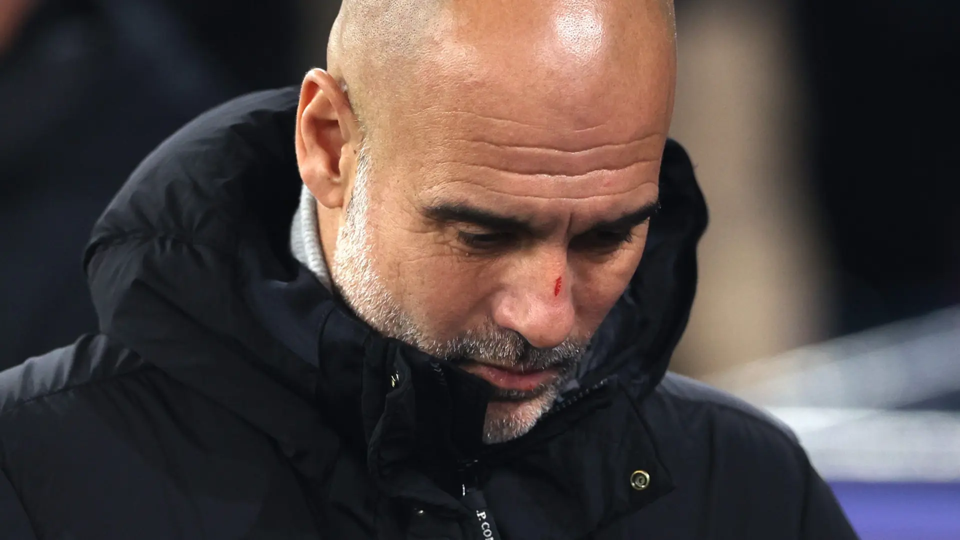 ¿Qué le ha ocurrido a Pep Guardiola?