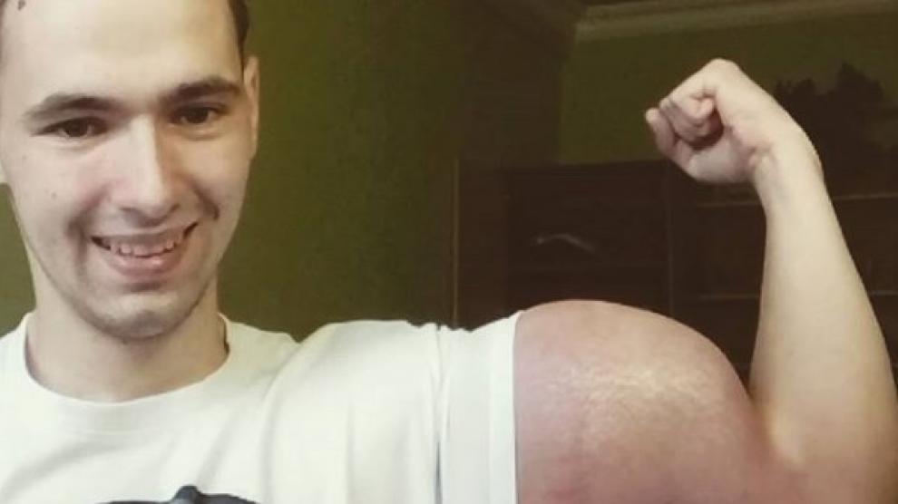 El 'Popeye ruso': un fisioculturista que se inyecta aceite en los ...