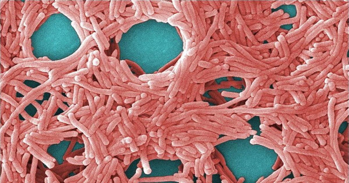 Salud Pública notifica un brote de legionelosis en un hospital de Zaragoza