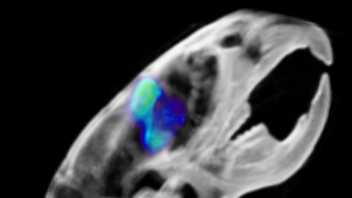 Una 'biopsia virtual' para ver el cáncer invisible | Noticias de Salud ...