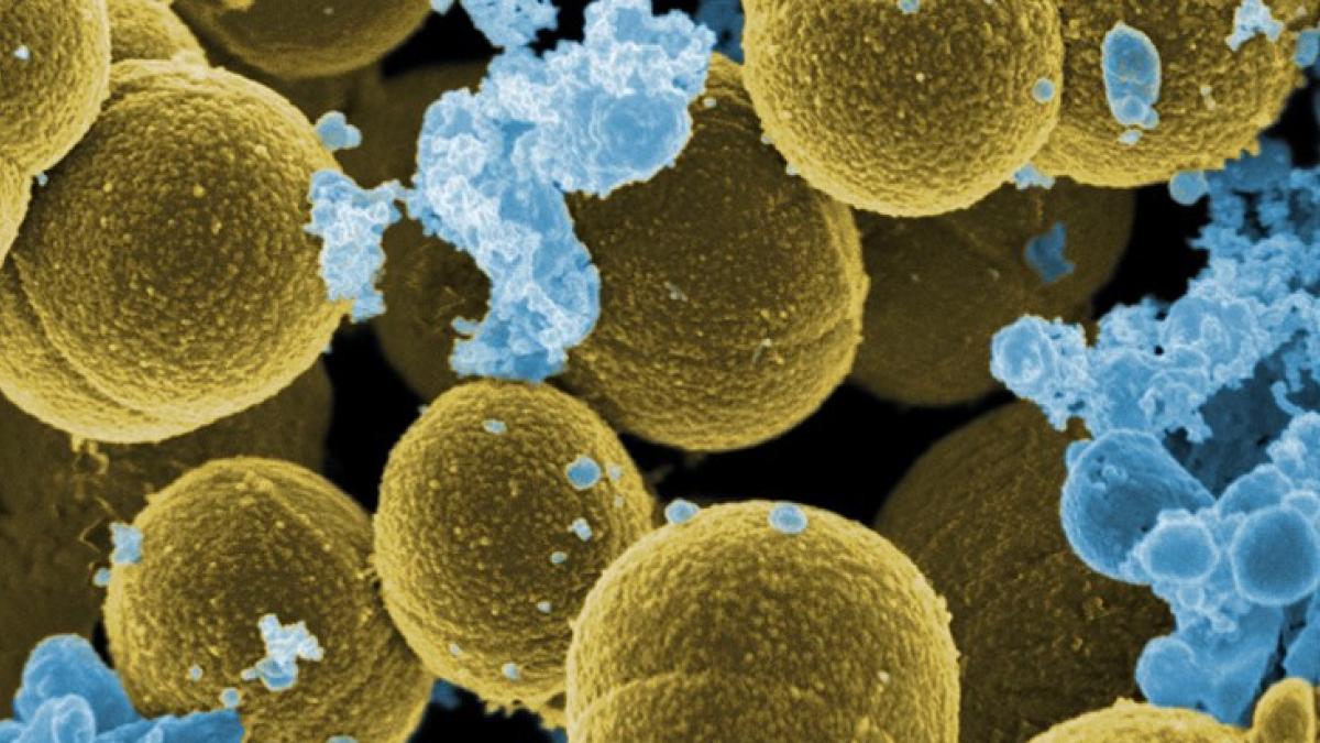 ¿Cómo se tratan las infecciones por estafilococos? | Noticias de Salud ...