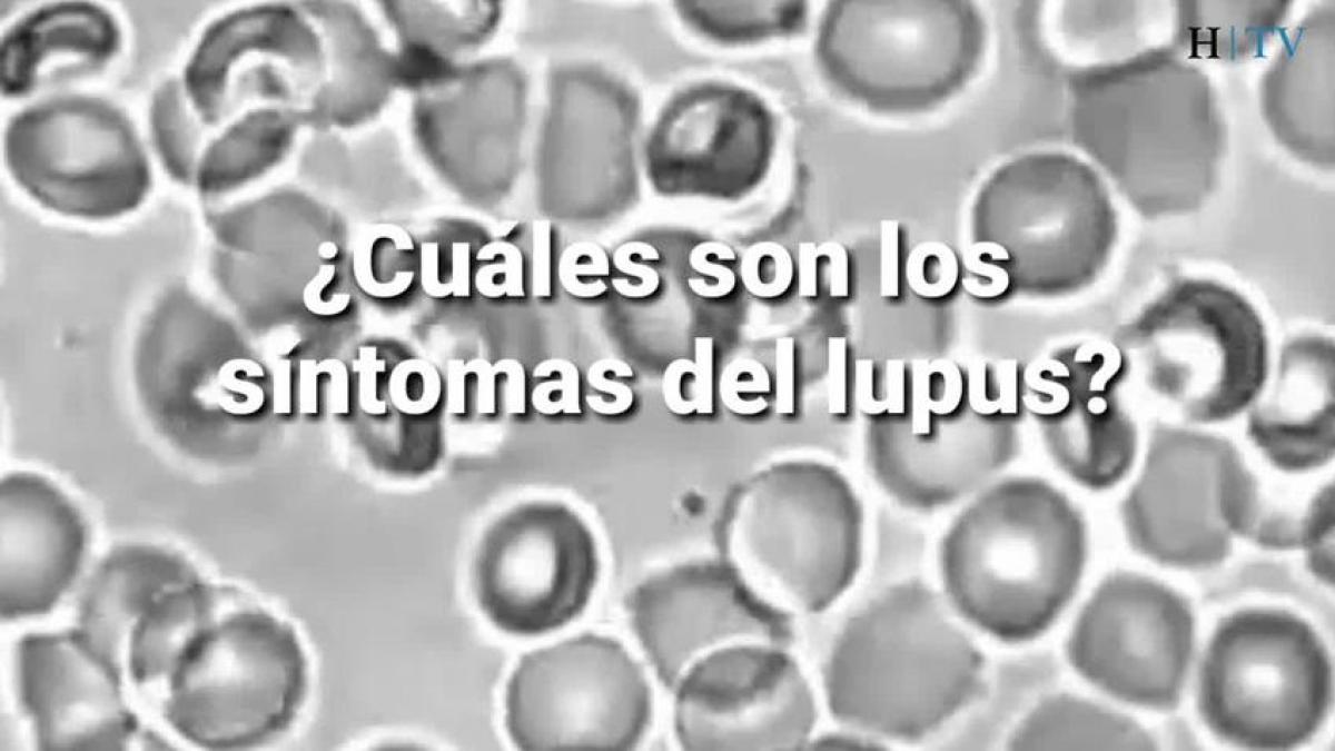 ¿Qué es el lupus? | Heraldo.es