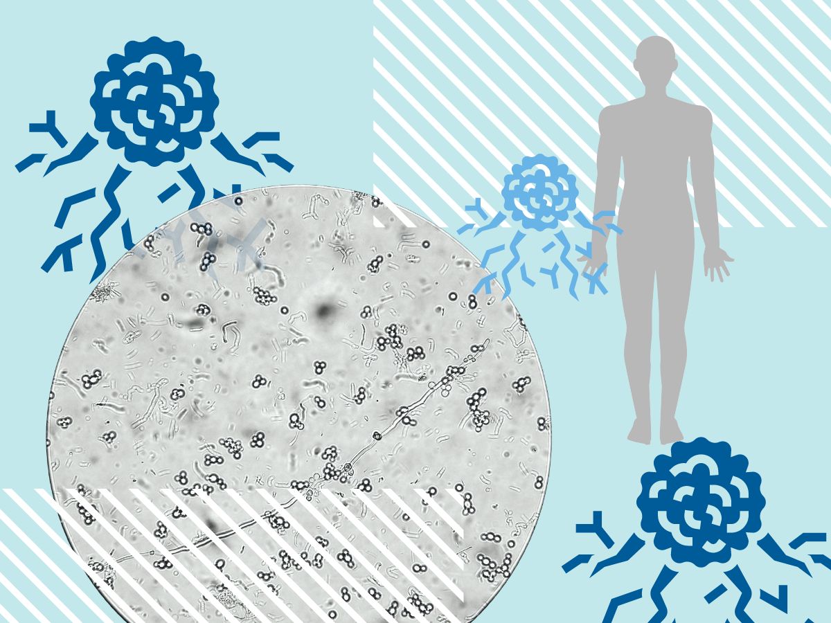 Qué es la Candida parapsilosis, síntomas y el tratamiento del hongo que ...
