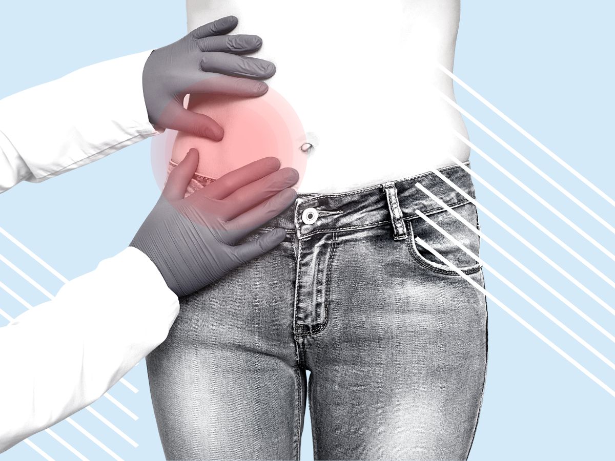 Qué es la peritonitis: síntomas, cómo detectarla y tratamiento