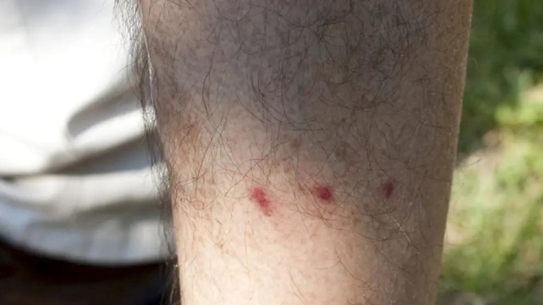 Mosca negra en Zaragoza: las zonas con más riesgo de picaduras